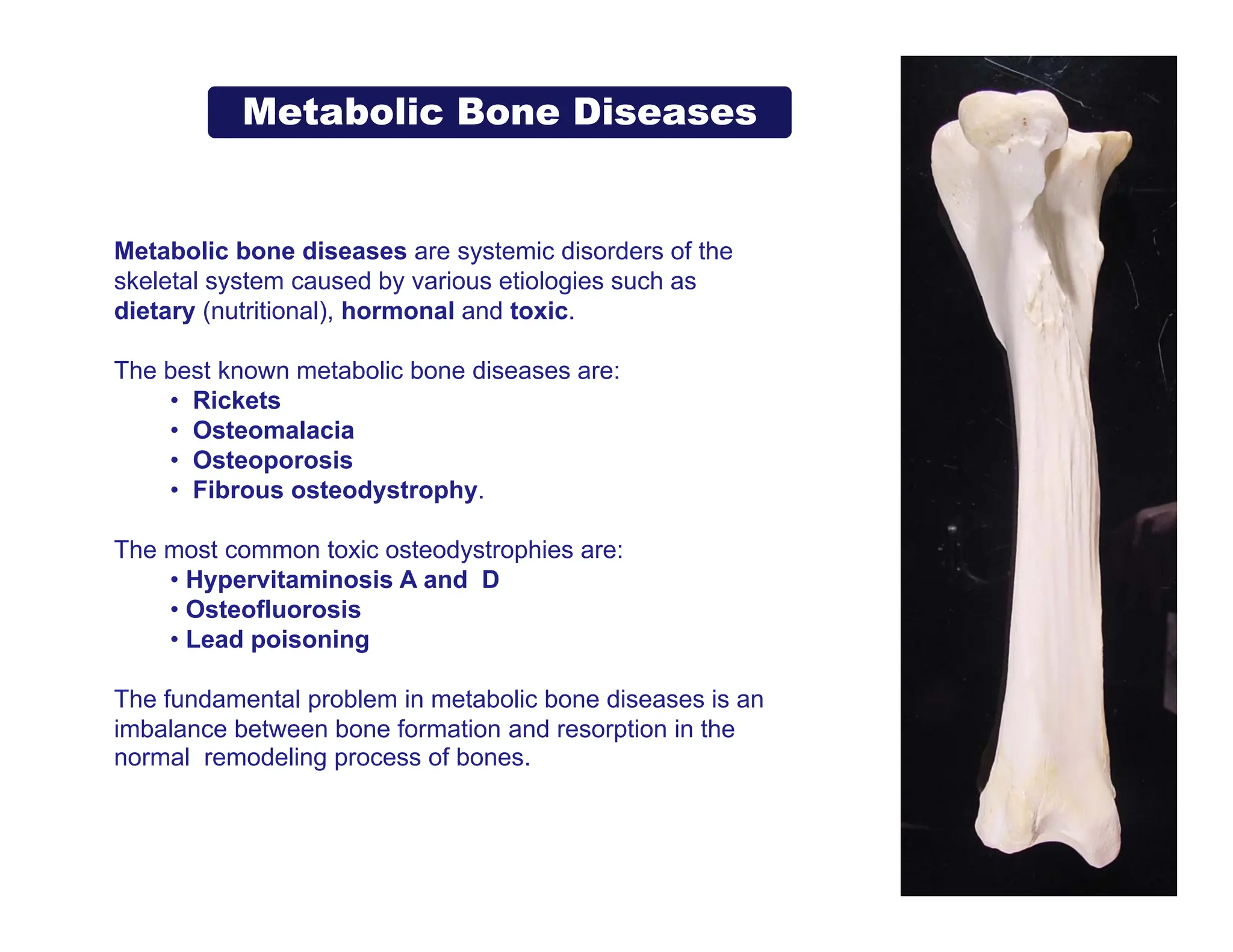 02_disease of bone_metabolic general.pdf