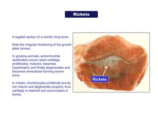 02_disease of bone_metabolic general.pdf