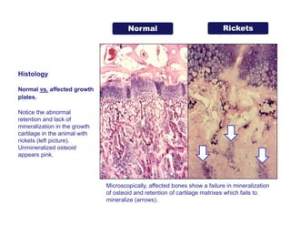 02_disease of bone_metabolic general.pdf
