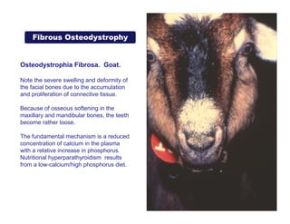 02_disease of bone_metabolic general.pdf