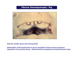 02_disease of bone_metabolic general.pdf