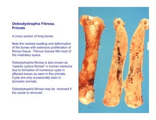 02_disease of bone_metabolic general.pdf