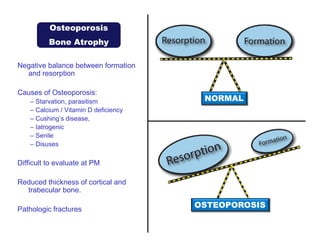 02_disease of bone_metabolic general.pdf