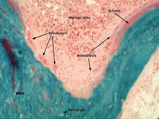 02 Bone Pathology Lec 1, ug cls, with gross and microscopy | PPT