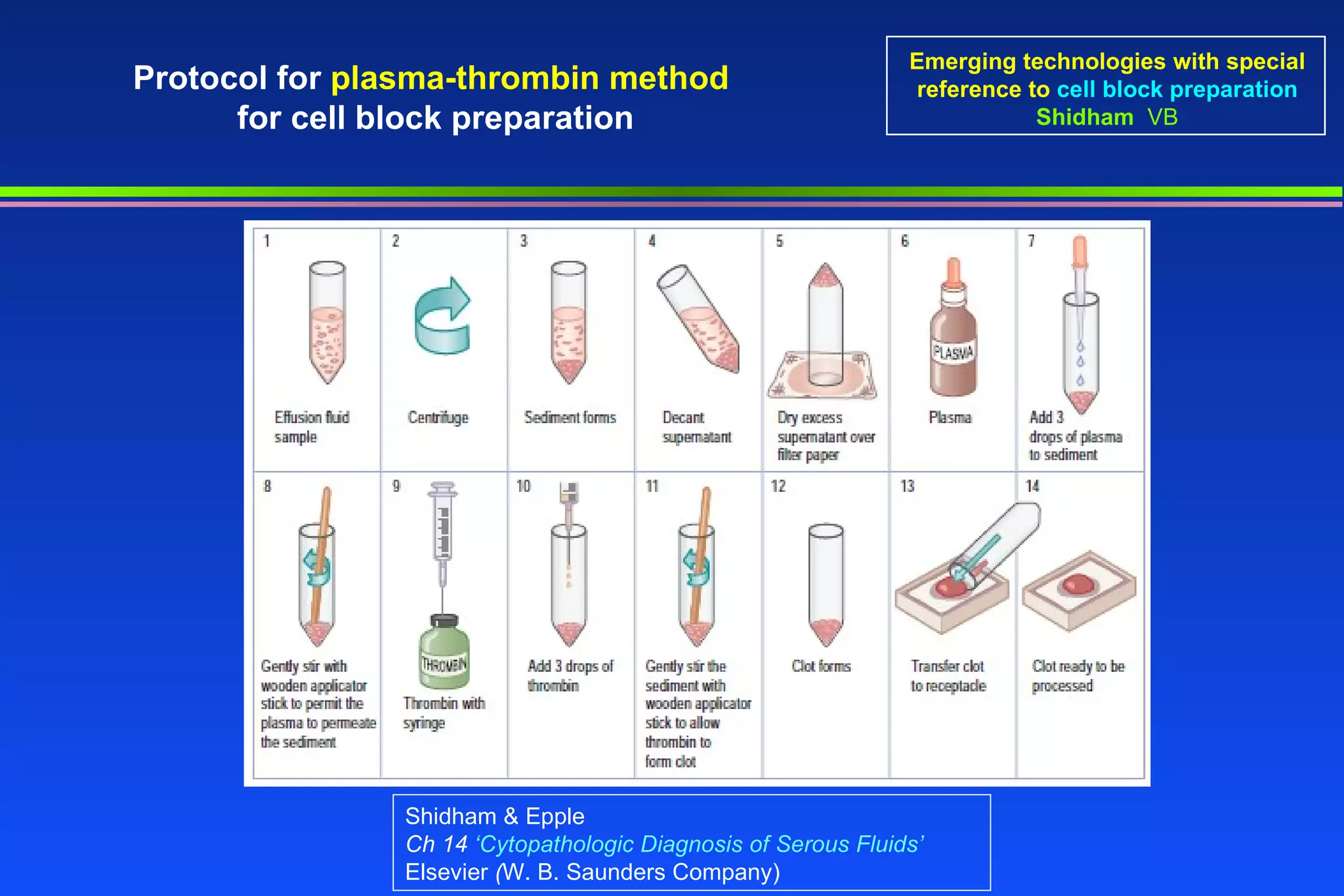 Shidham's protocol for cell block preparation | PPS