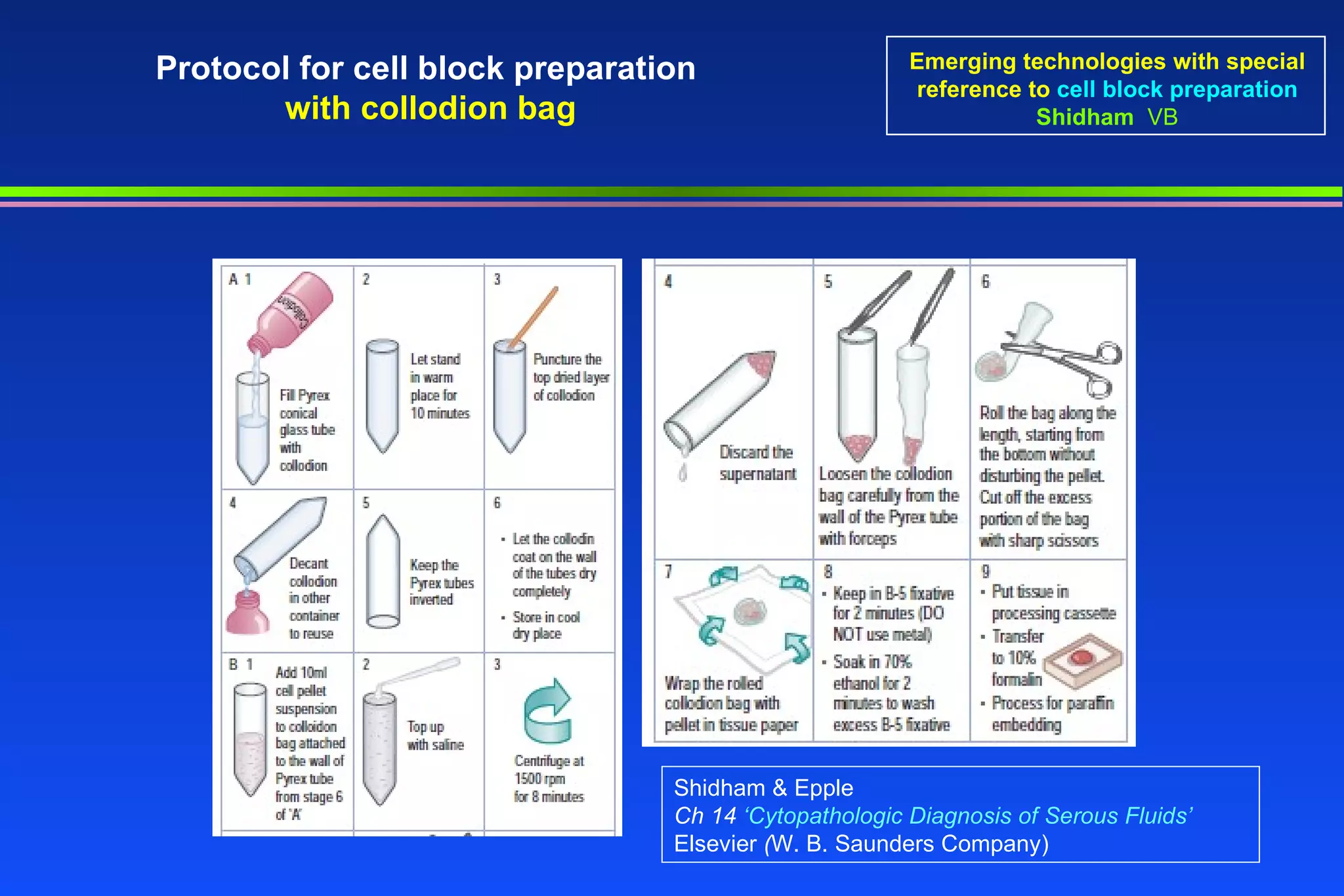Shidham's protocol for cell block preparation | PPS
