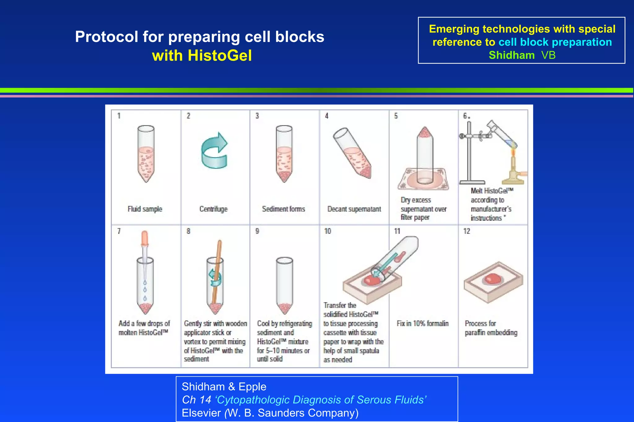 Shidham's protocol for cell block preparation | PPS