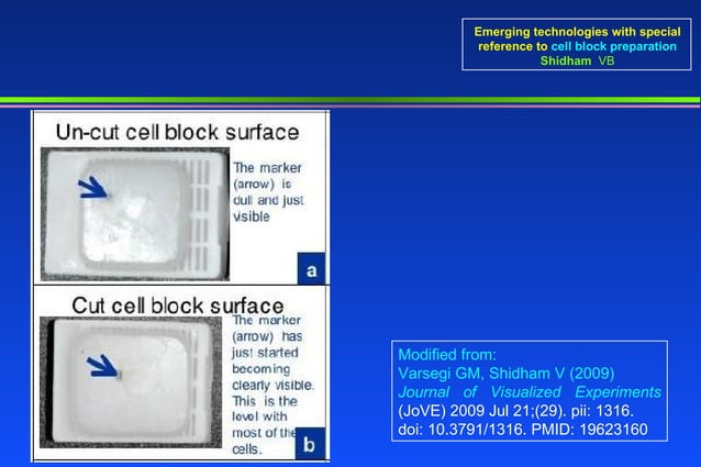 Shidham's protocol for cell block preparation | PPT
