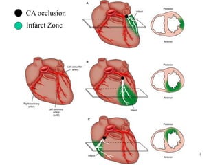 02 cardiac pathology | PPT