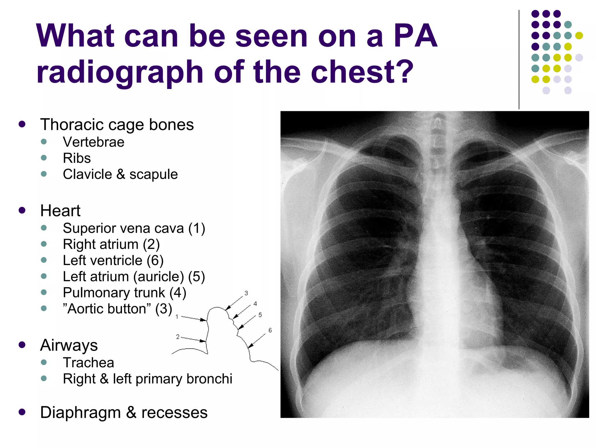chest | PPT