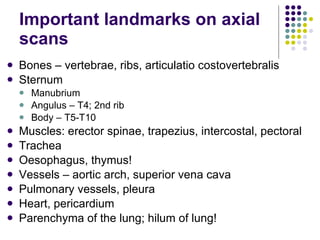 chest | PPT
