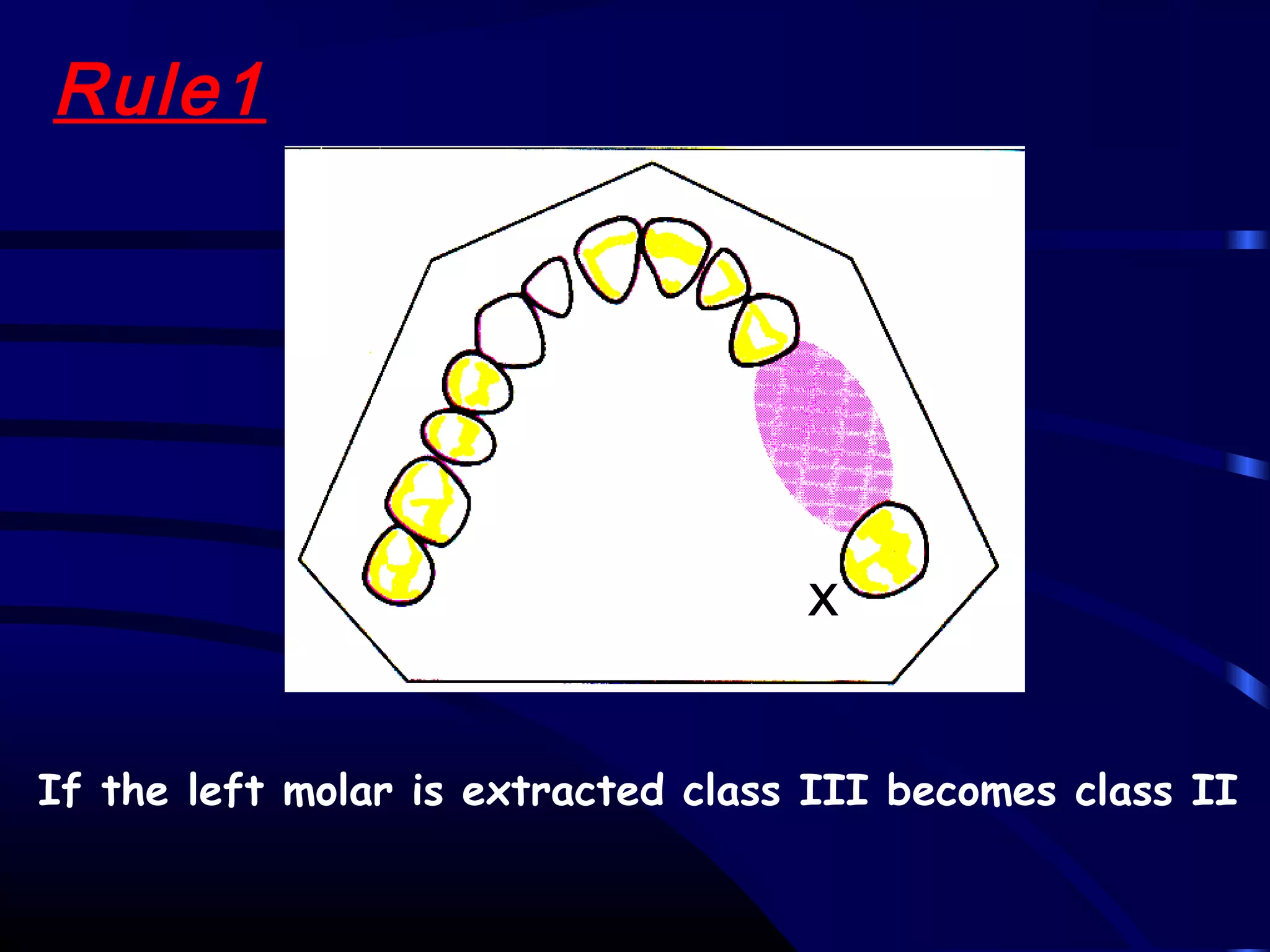 02 classification and indications of rpd | PPT