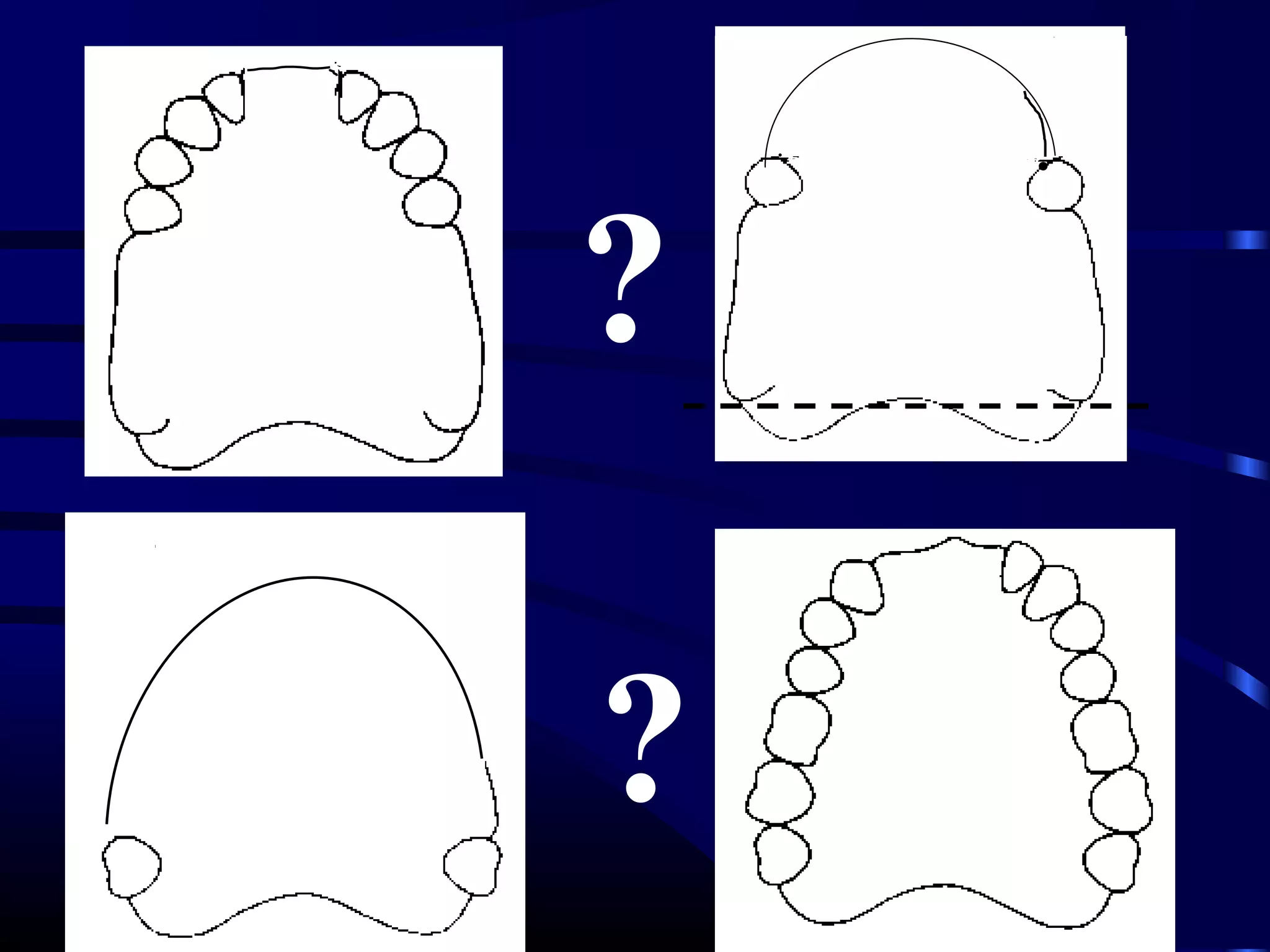 02 classification and indications of rpd | PPT