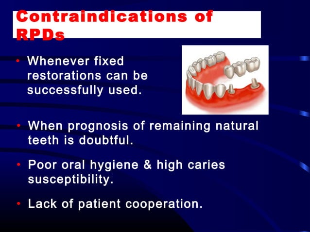 02 classification and indications of rpd | PPT