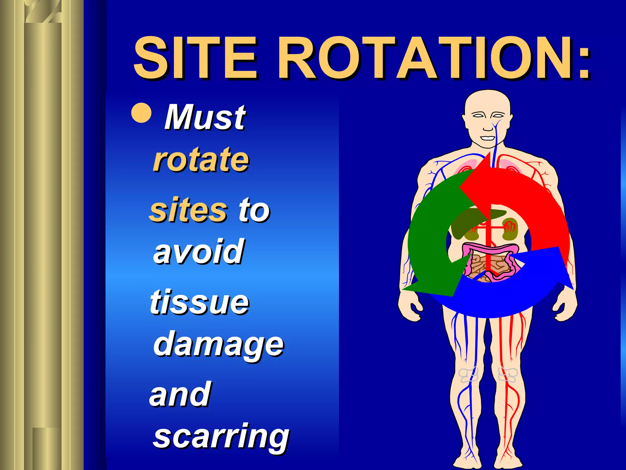 INJECTION SITES | PPT