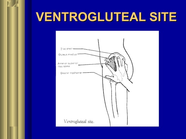 INJECTION SITES | PPT