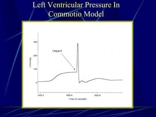 Sudden Cardiac Death by Chest Wall Impact: Commotio Cordis | PPTX