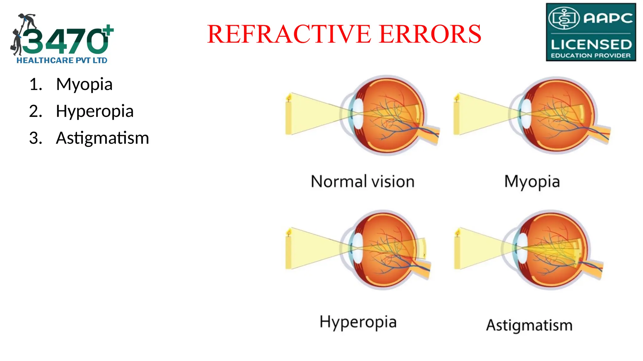 Eye_visual system [all about eye]....... | PPTX | Eye and Vision ...