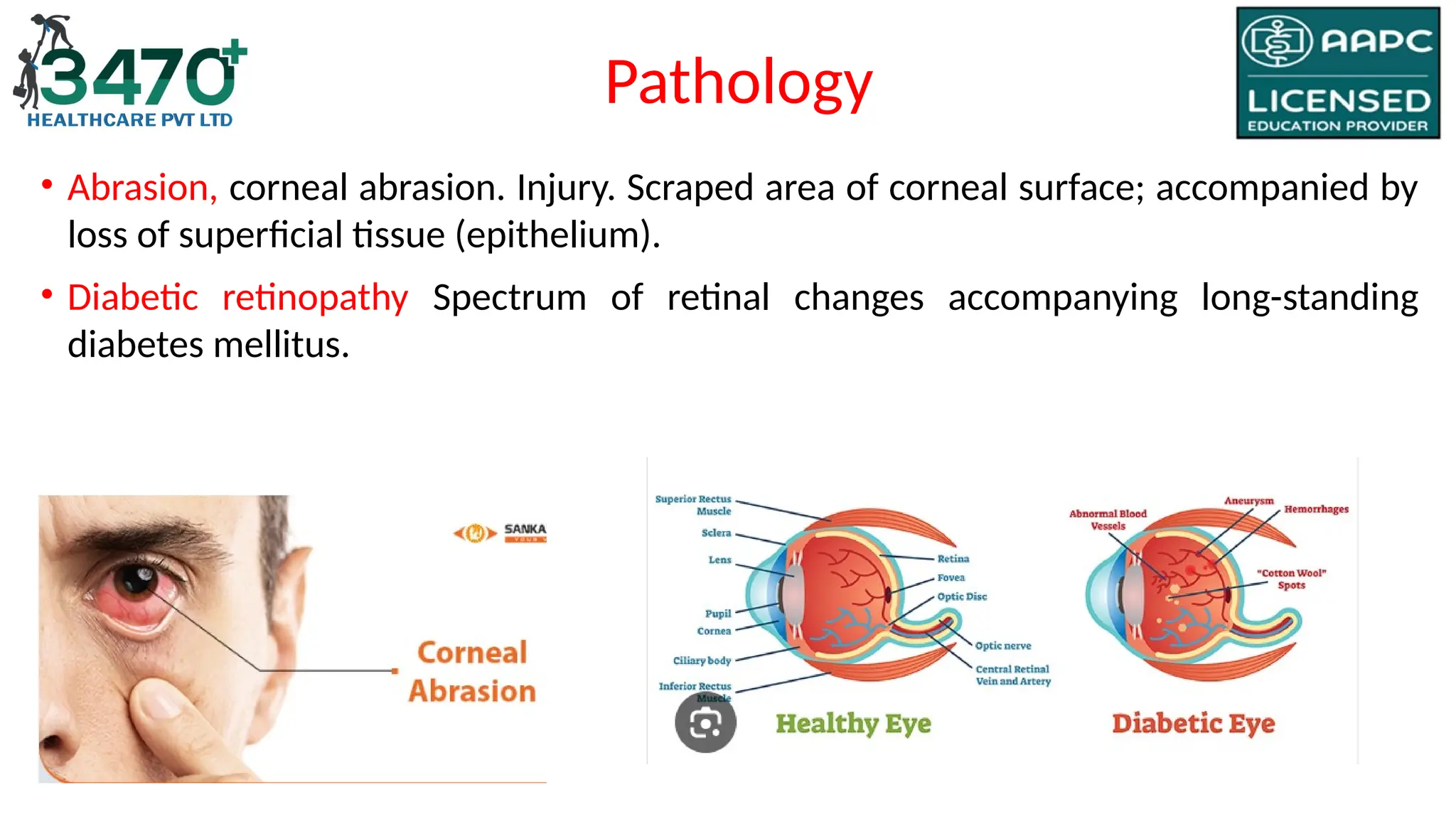 Eye_visual system [all about eye]....... | PPTX | Eye and Vision ...