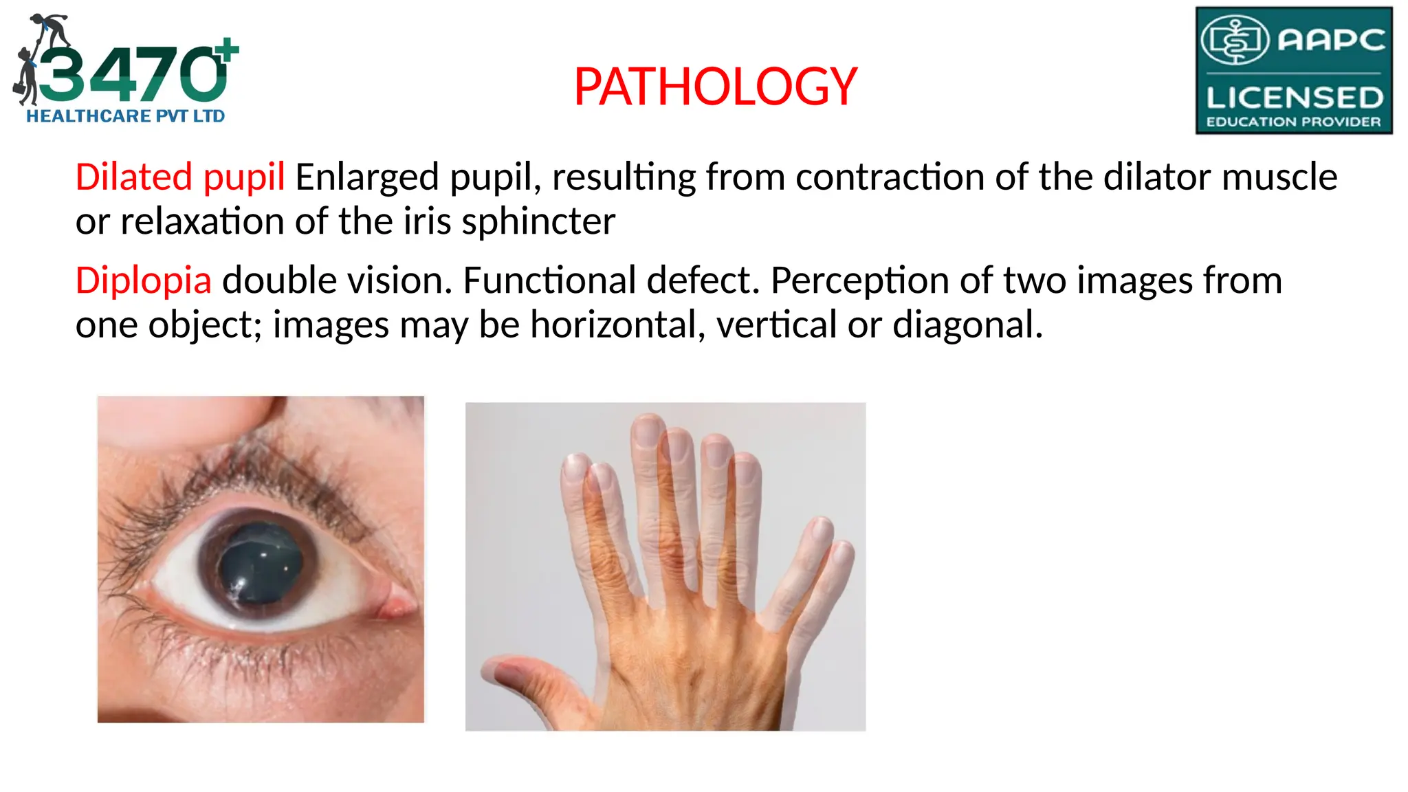 Eye_visual system [all about eye]....... | PPTX | Eye and Vision ...