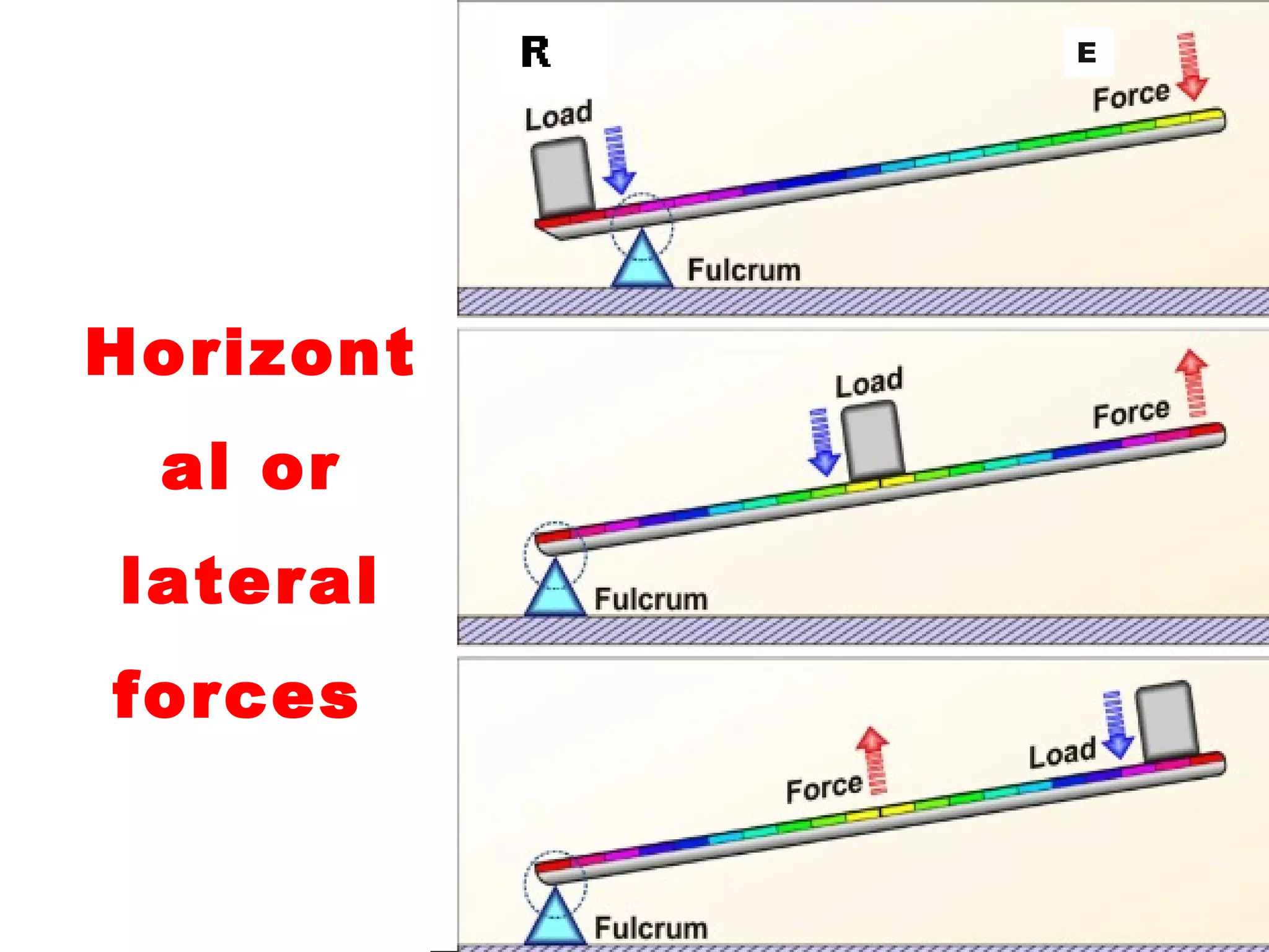 1. forces acting on rpd | PPT