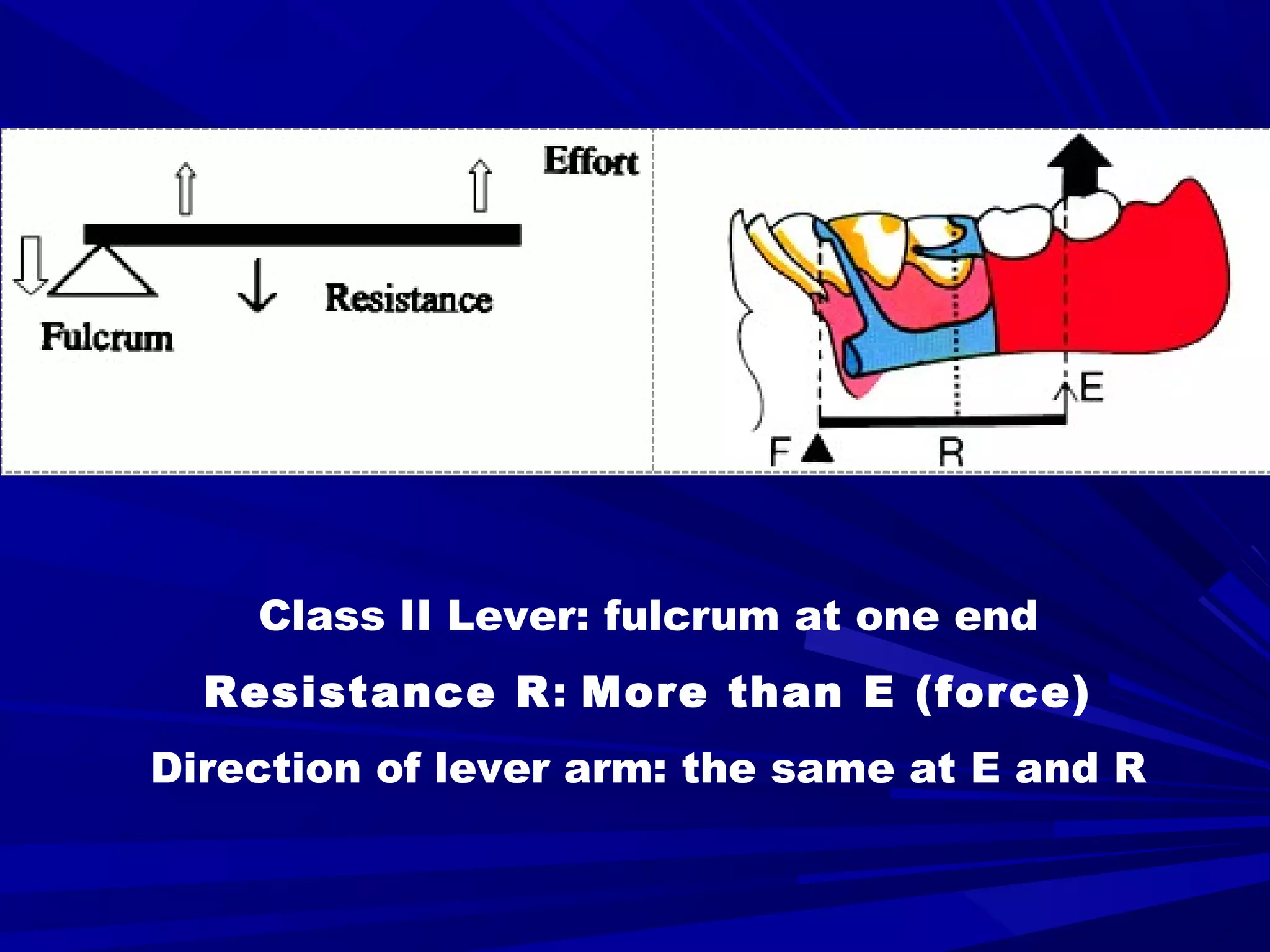 1. forces acting on rpd | PPT