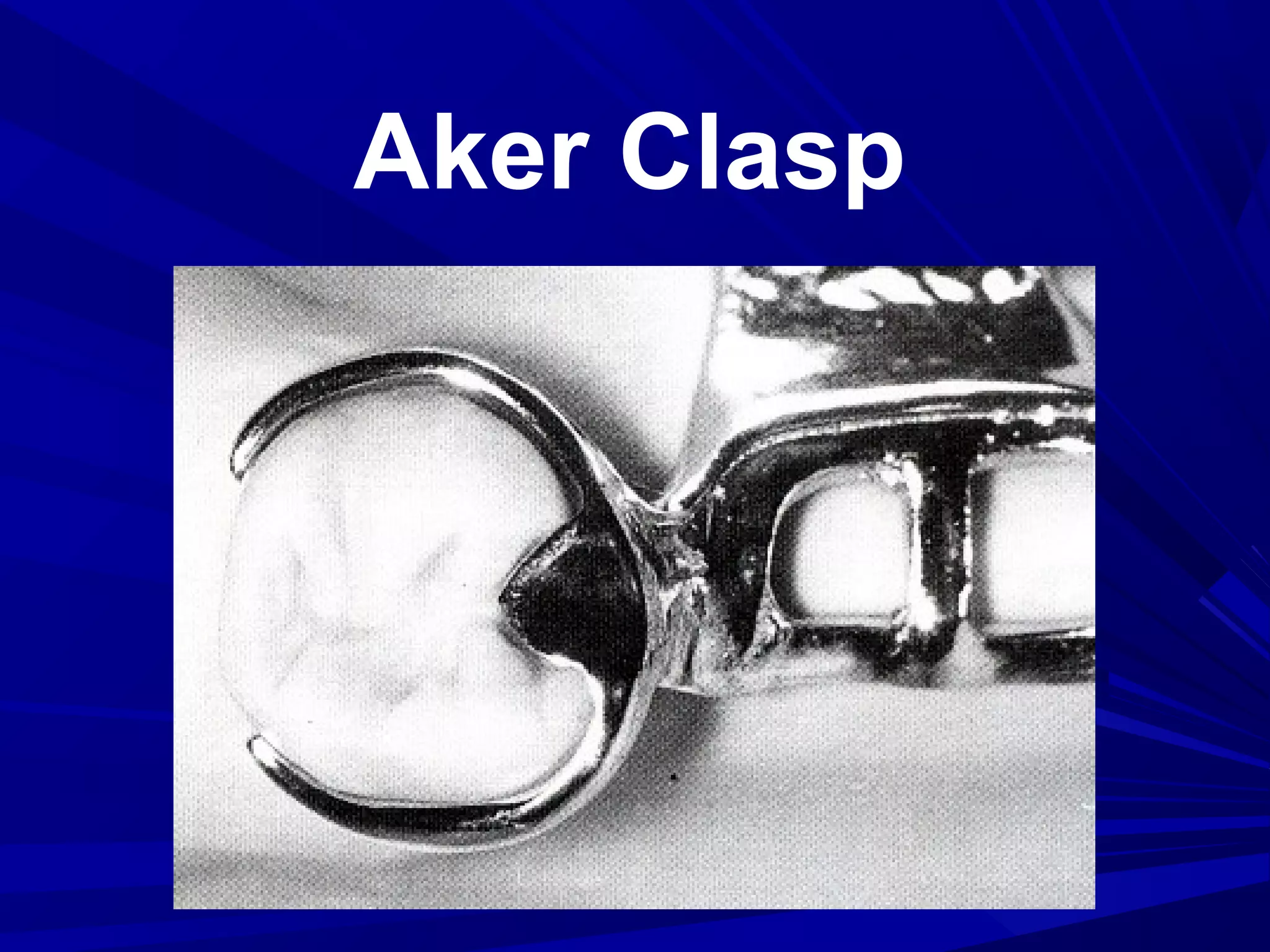 1. forces acting on rpd | PPT