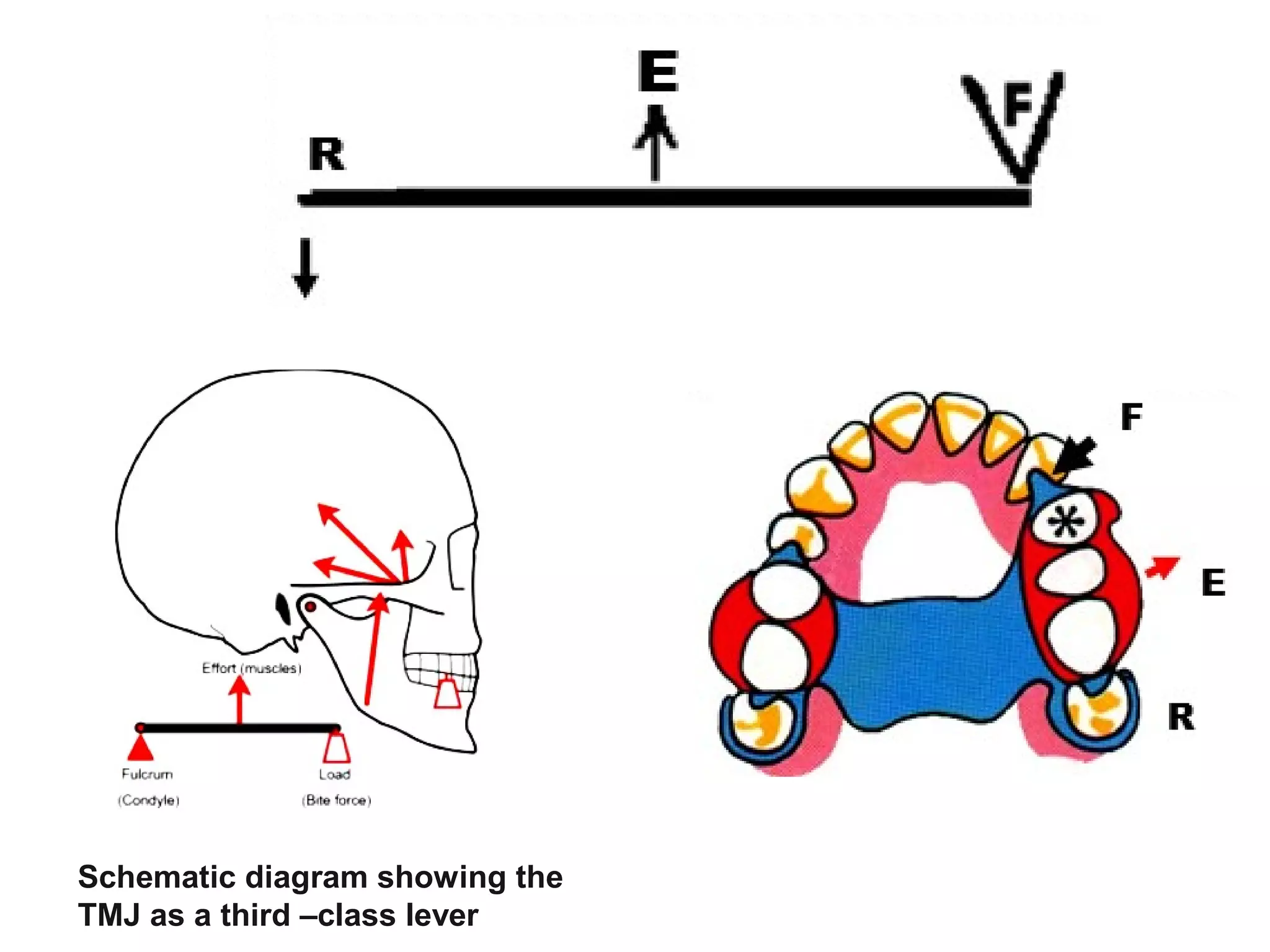 1. forces acting on rpd | PPT