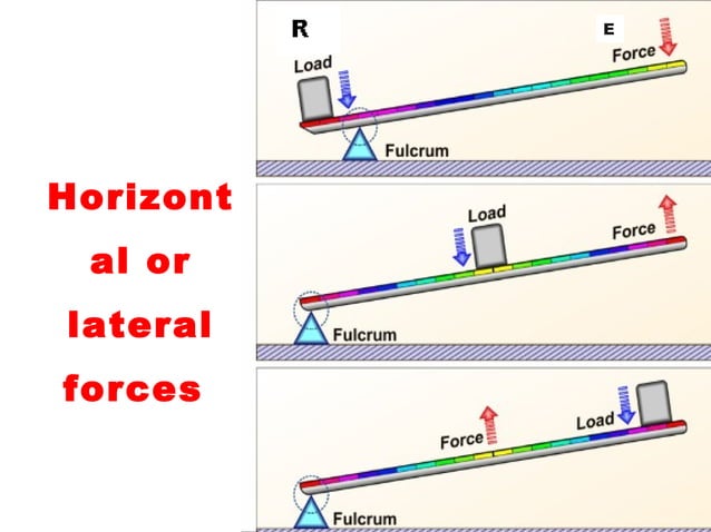 1. forces acting on rpd | PPT