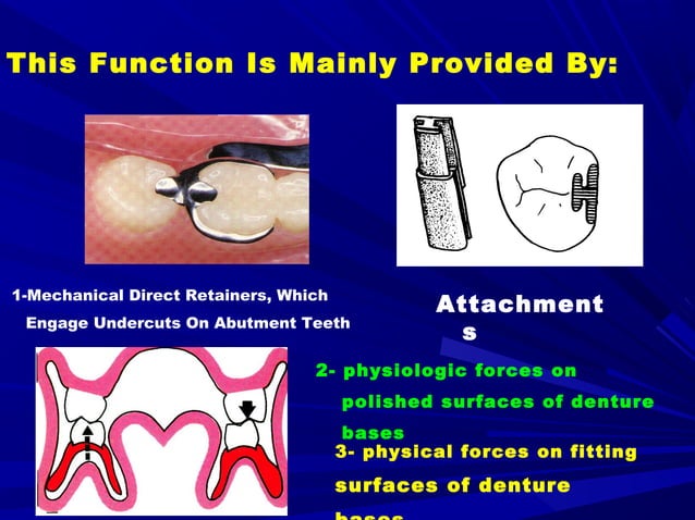 1. forces acting on rpd | PPT