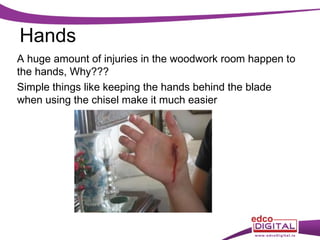 02 health safety | PPT | Woodworking | Arts and Crafts
