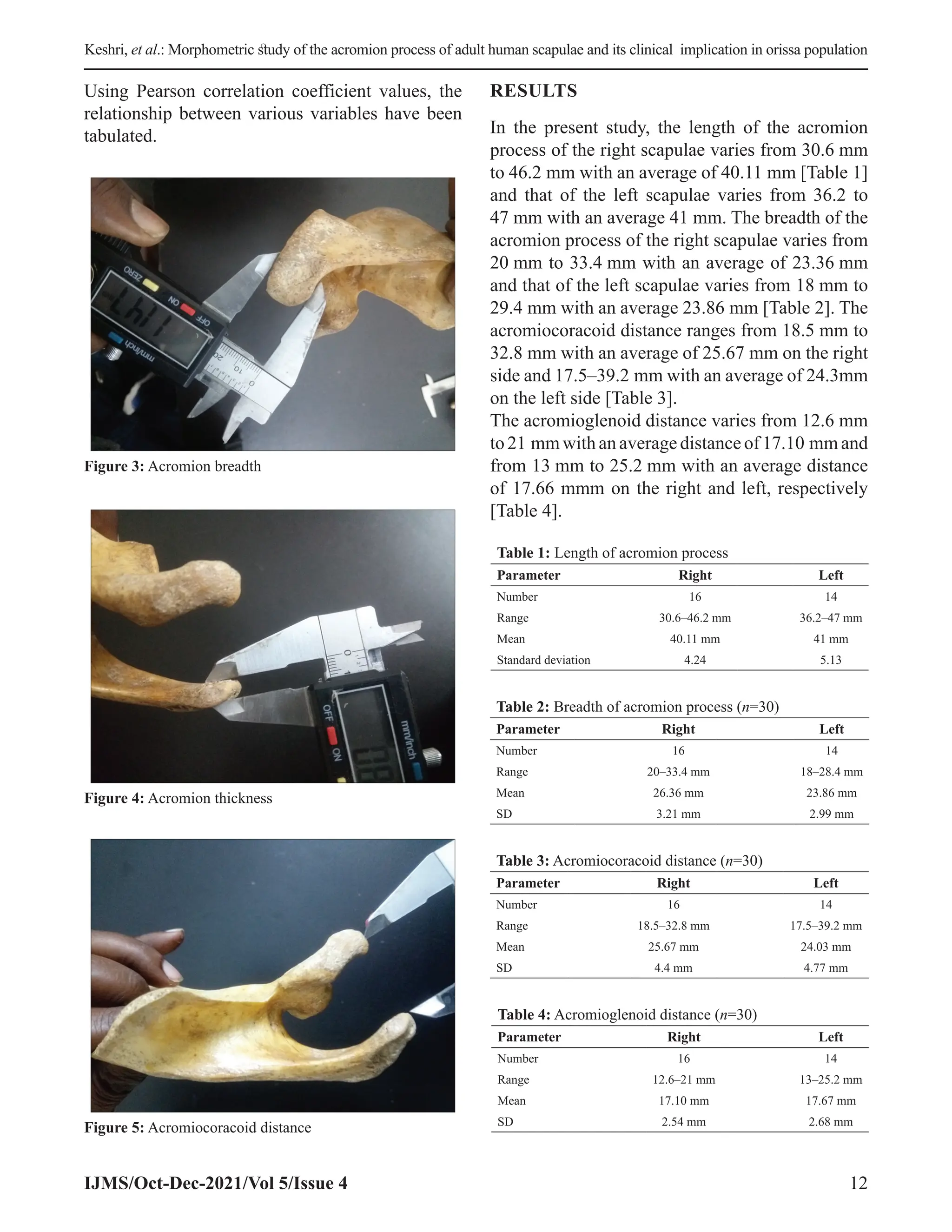 Morphometric study of the acromion process of adult human scapulae and ...