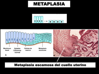 02 Lesión, daño y muerte celular - copia.pptx