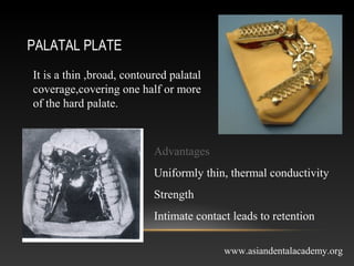 mejor connectors in removable partial dentures | PPT