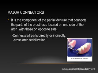 mejor connectors in removable partial dentures | PPT