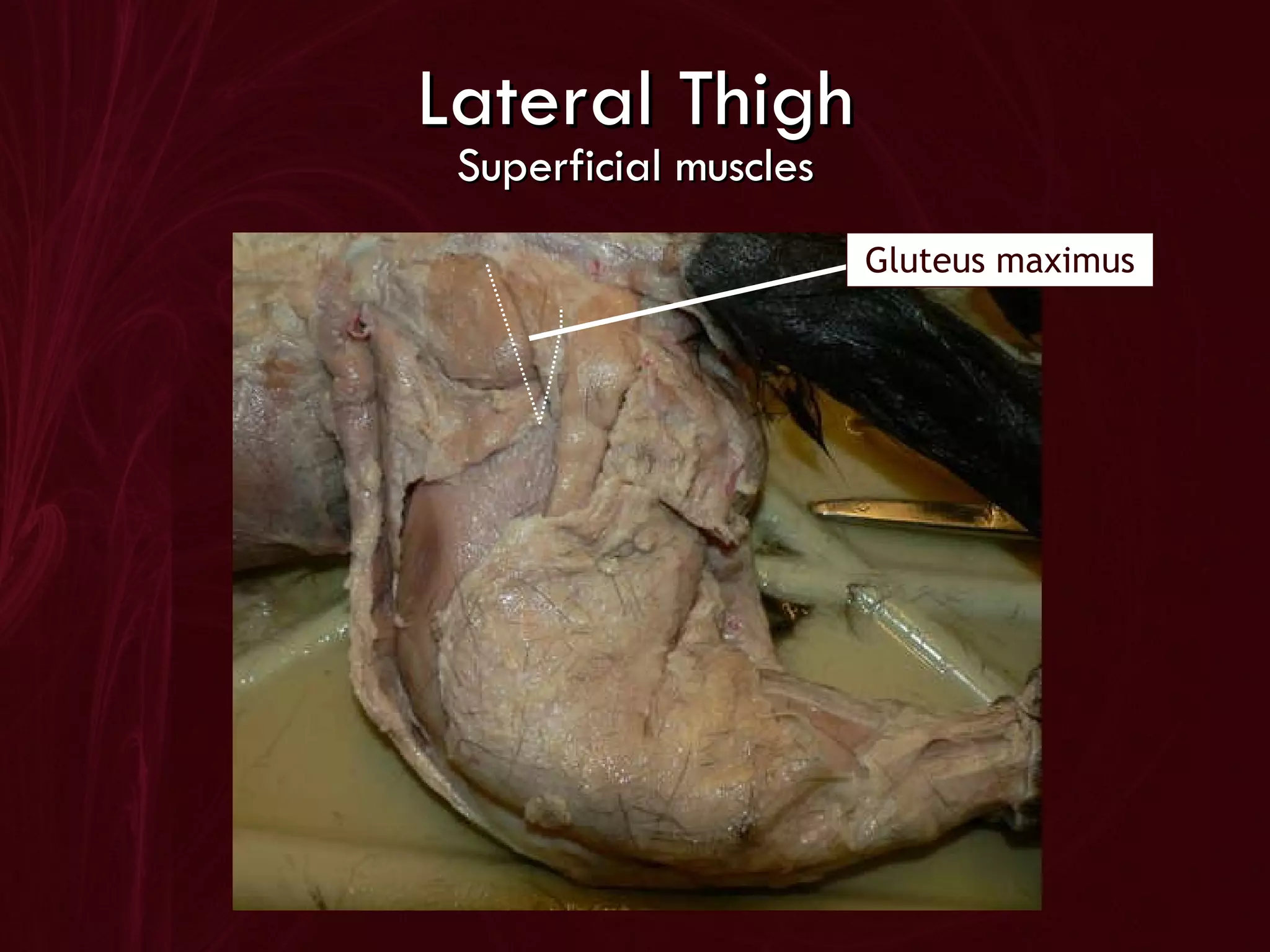 Lab2 Muscles Part 1 | PPT