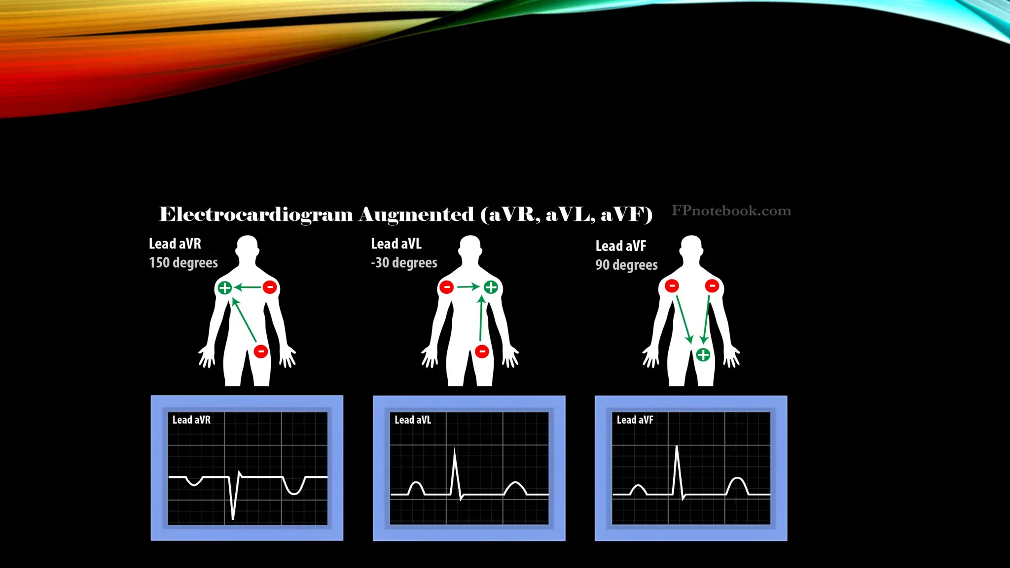 ELECTROCARDIOGRAPHY(ECG)_Autosaved.pptx. | PPTX | Heart and ...