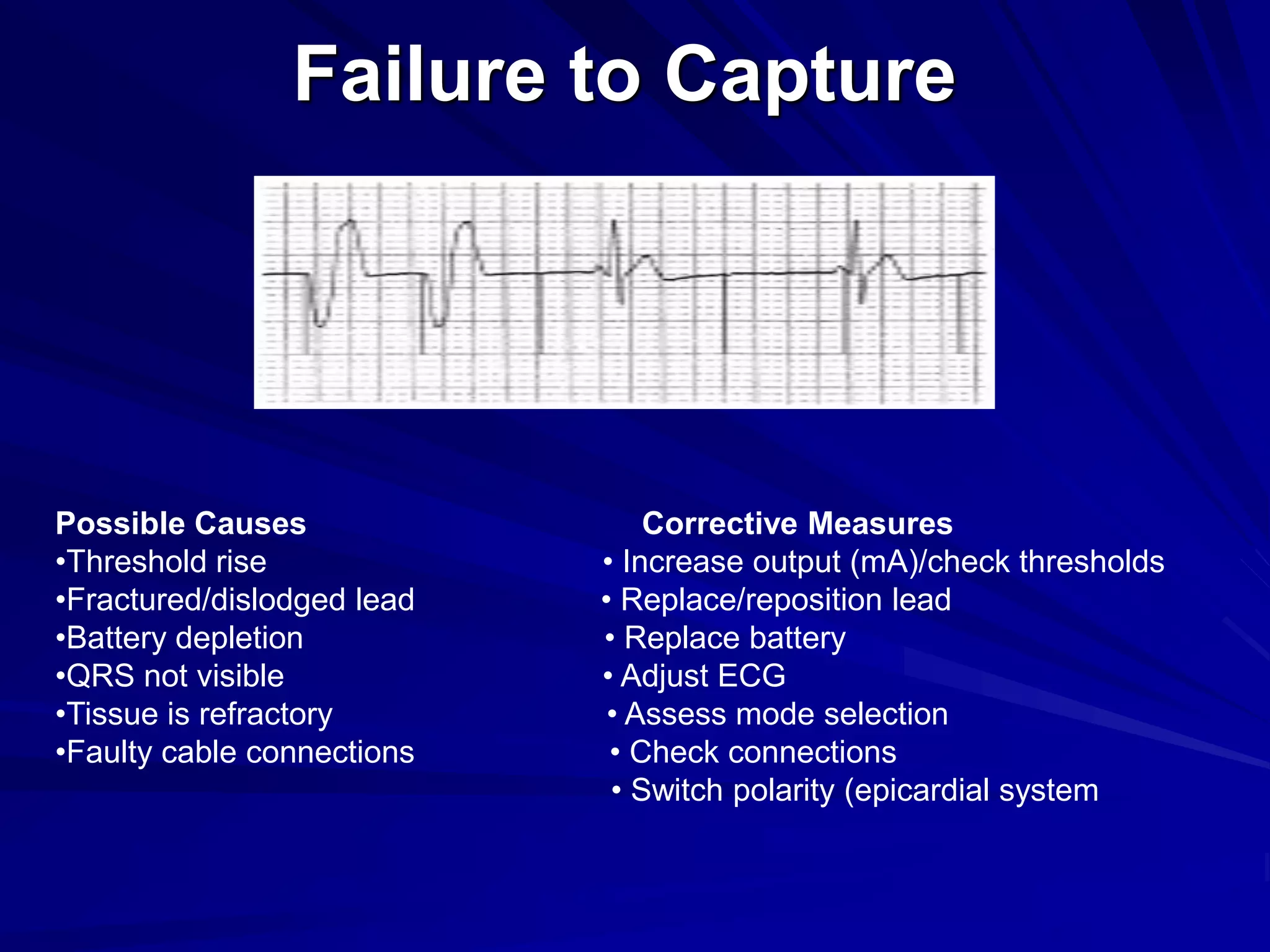 02 pacemakers and ic ds an overview-samir rafla | PDF