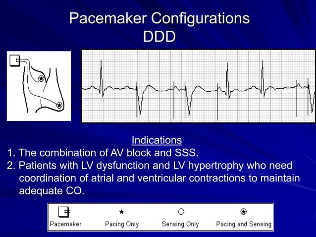02 pacemakers and ic ds an overview-samir rafla | PPT