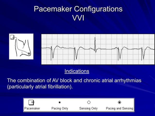 02 pacemakers and ic ds an overview-samir rafla | PPT