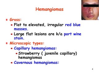 Pediatric tumors | PPT