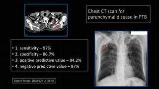 02 pleural disease 2019 radiology | PDF