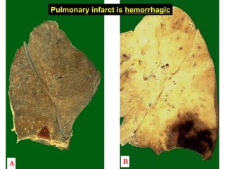02 respiratory vascular | PPT