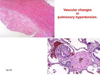 02 respiratory vascular | PPT