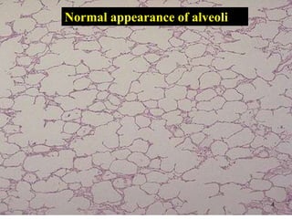 02 respiratory vascular | PPT