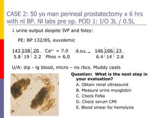 02 Sperati Prevention And Management Of Acute Renal Failure | PPT