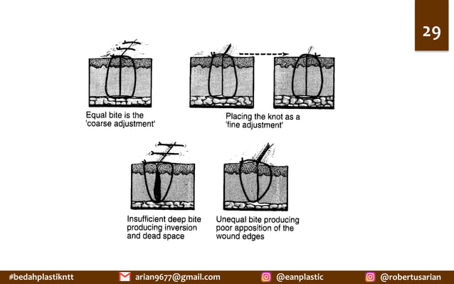 Tata Laksana Luka Akut dan Kronis (Pembaruan 2025) | PDF