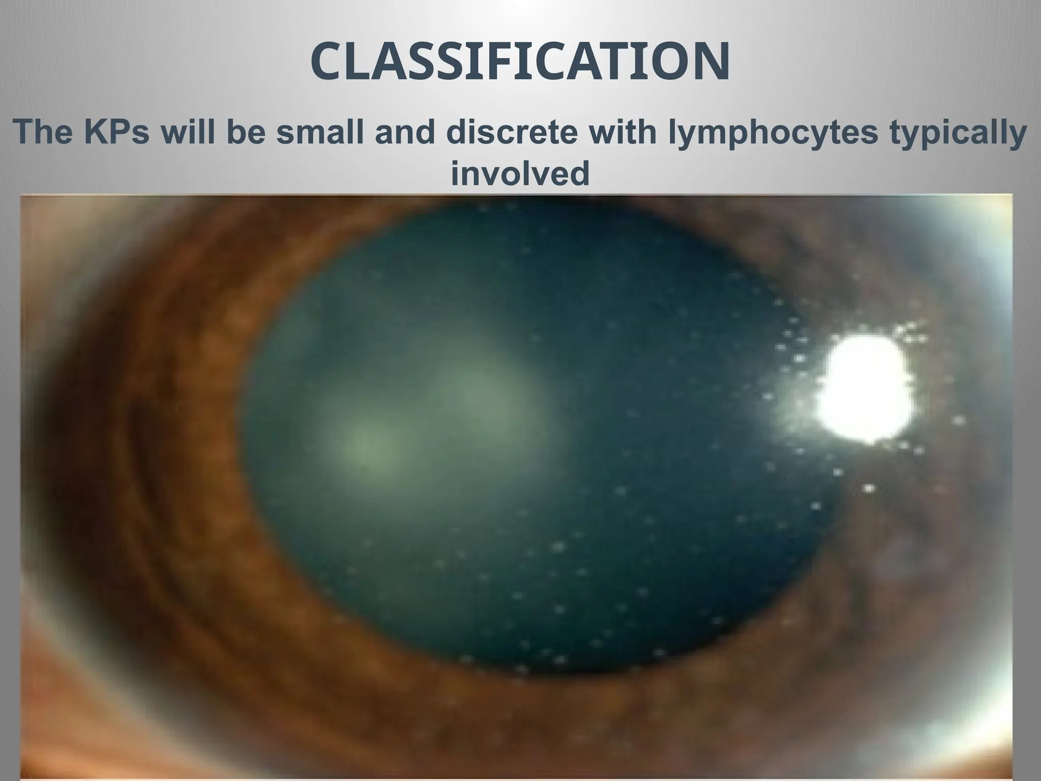 common eye disorder : uveitis ppt (infamation of uvea) | PPT