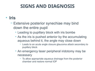 common eye disorder : uveitis ppt (infamation of uvea) | PPTX