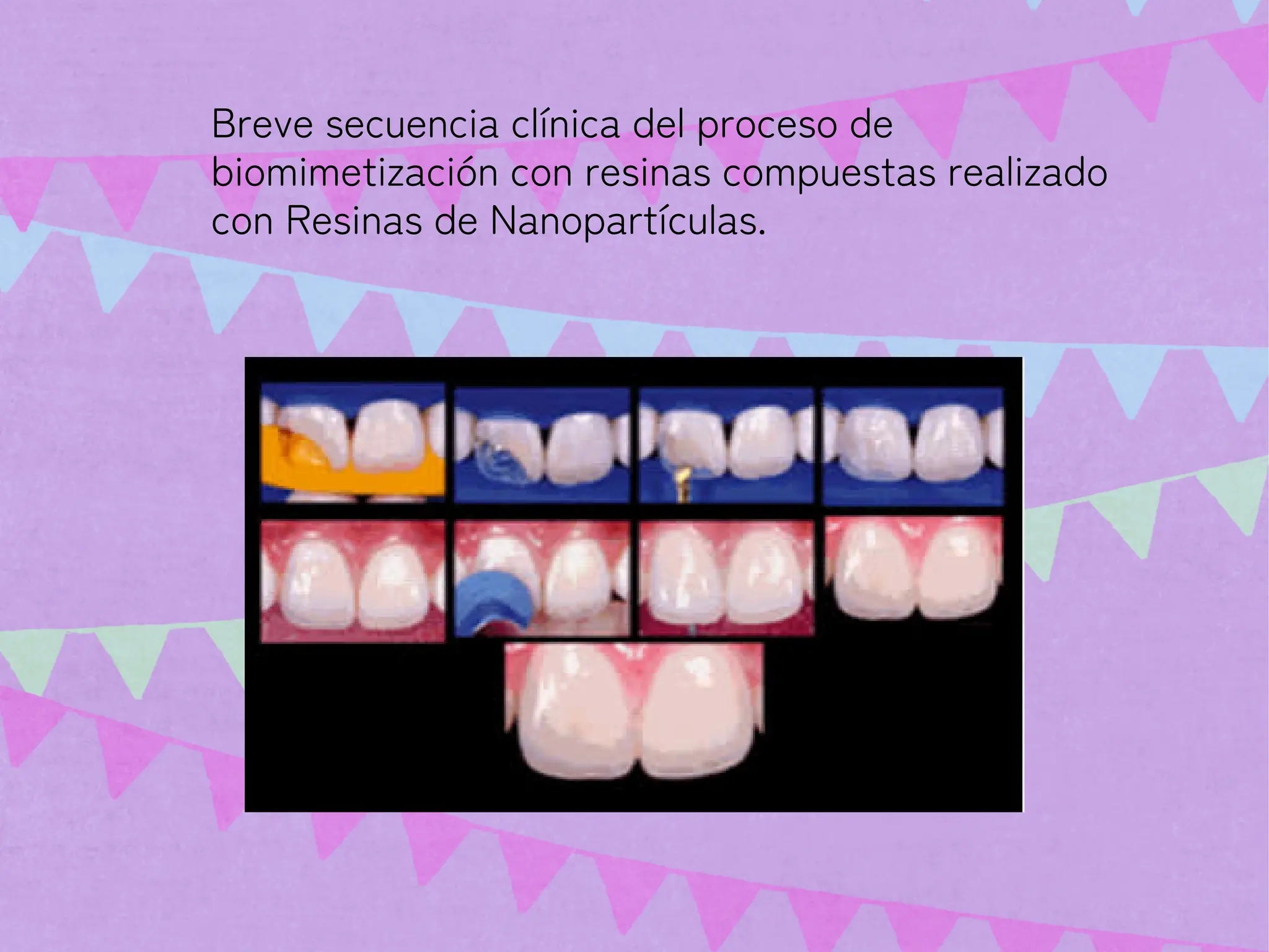 resinas compuestas clasificacion y composición.pdf